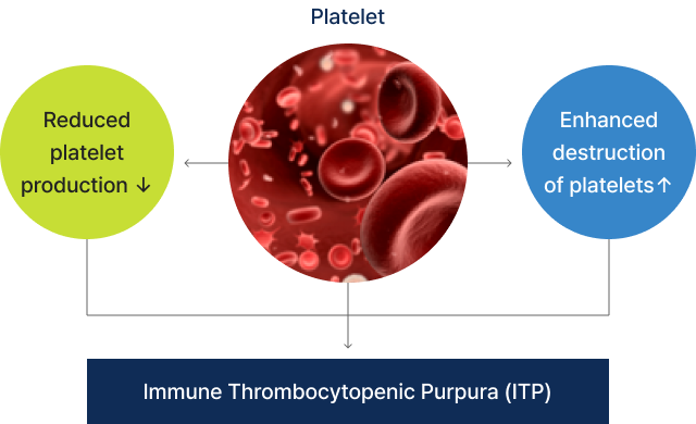 Immune thrombocytopenic purpura (ITP) · Disease information | Bone ...