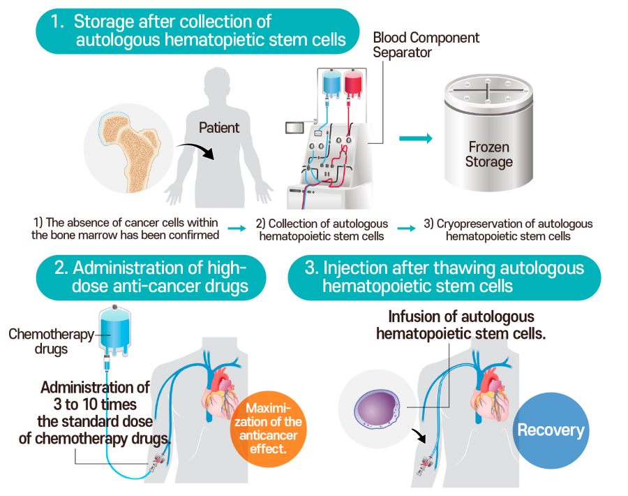 Hematopoietic Stem Cell Transplantation · Autologous Hematopoietic Stem ...