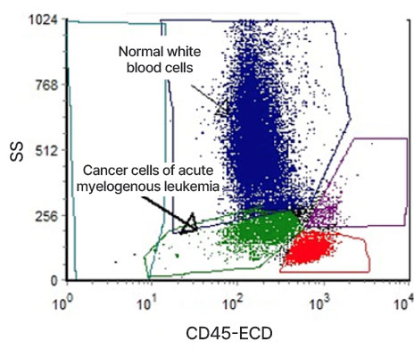 Flow Cytometry Test | Diagnostic Test Information | Medical Information ...